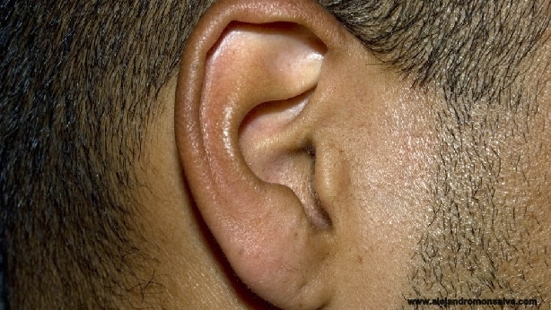 Tratamientos de belleza especiales para las orejas